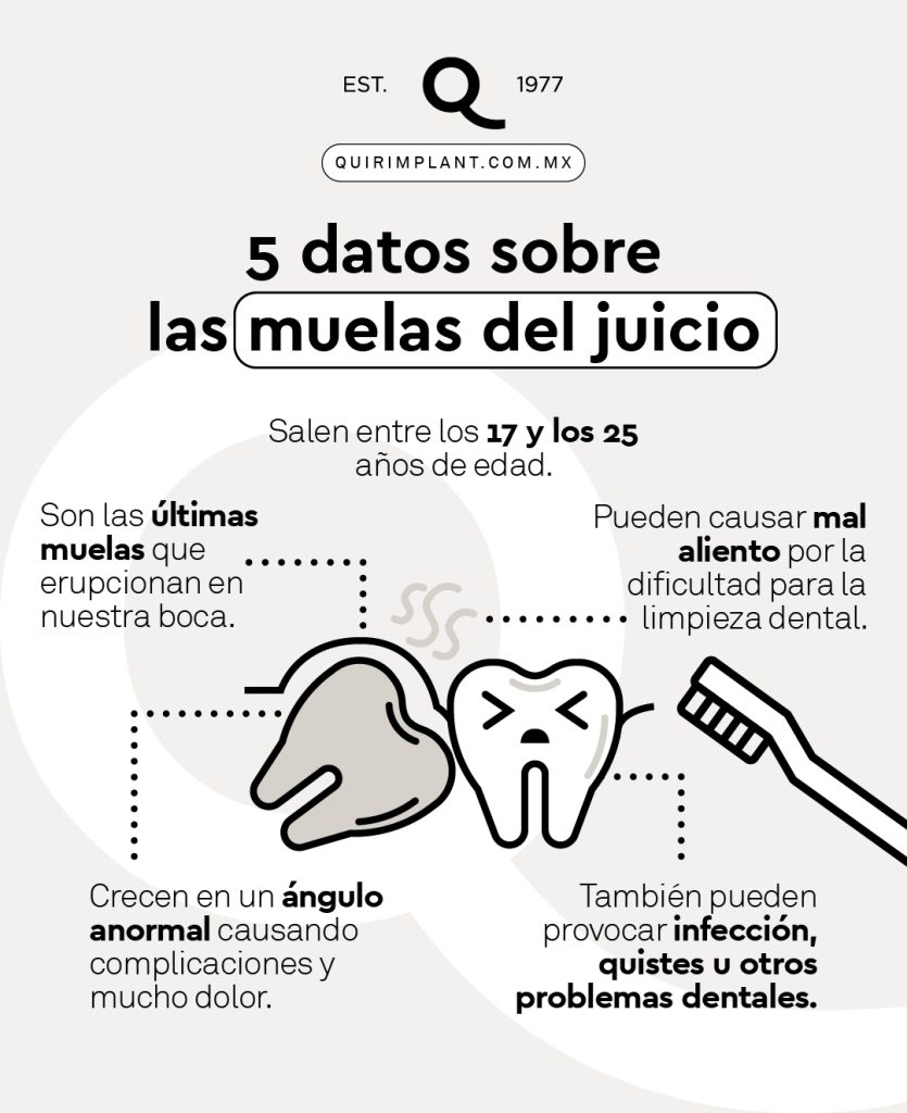 Extracción de las muelas del juicio - Quirimplant